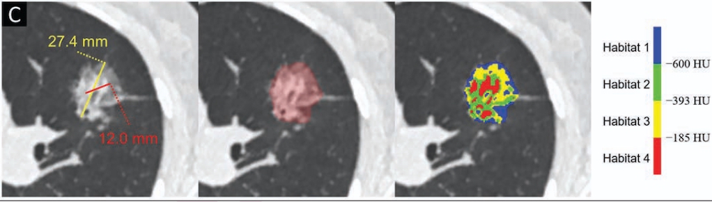 Une nouvelle approche tomodensitométrique pour explorer les
